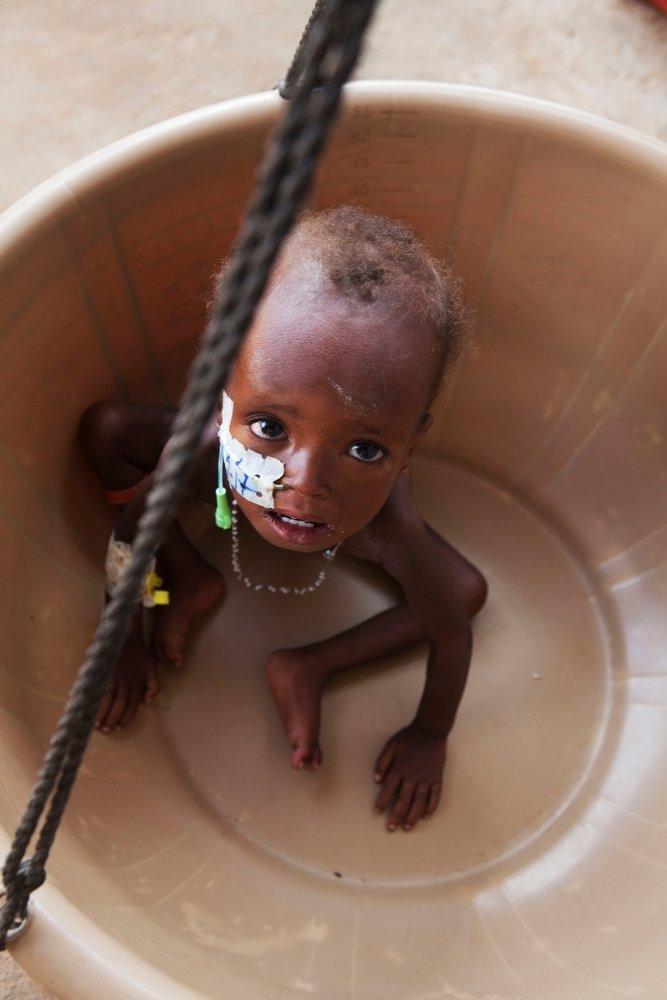 Niger: MSF warns of impending threat from deadly combination of malaria ...