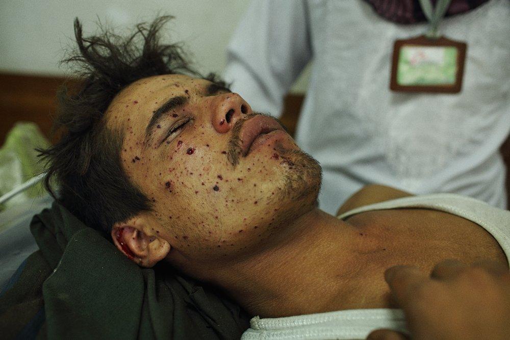 Afghanistan: MSF treating dozens of wounded after heavy fighting in ...