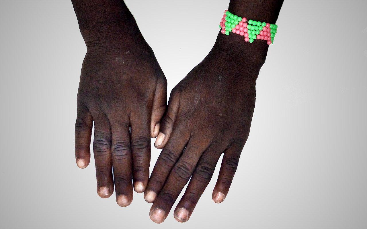 Diffa, Niger: Aïcha’s story | MSF Southern Africa